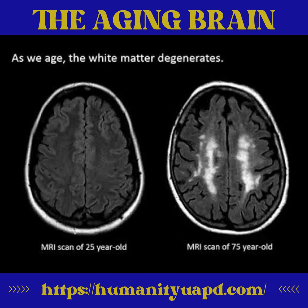 Aging Brain: 7 Proven Ways To Boost Memory Power